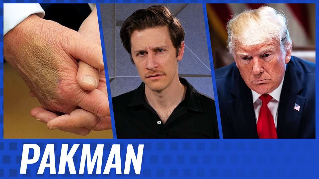 Bruised hands trigger panic, Americans leaving USA in record numbers 2/25/25 TDPS Podcast | One-News